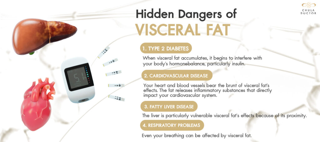 Visceral Fat: The Hidden Danger You Shouldn’t Ignore – Chuladoctor Wellness